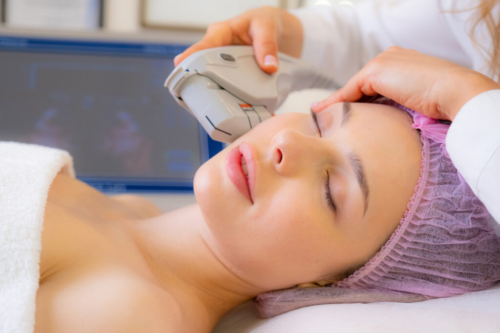 Erasing Spots, Revealing Radiance: Pigmentation Laser Treatments ...